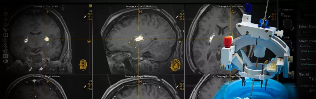 SmartFrame Array Neuro Navigation System - ClearPoint Neuro