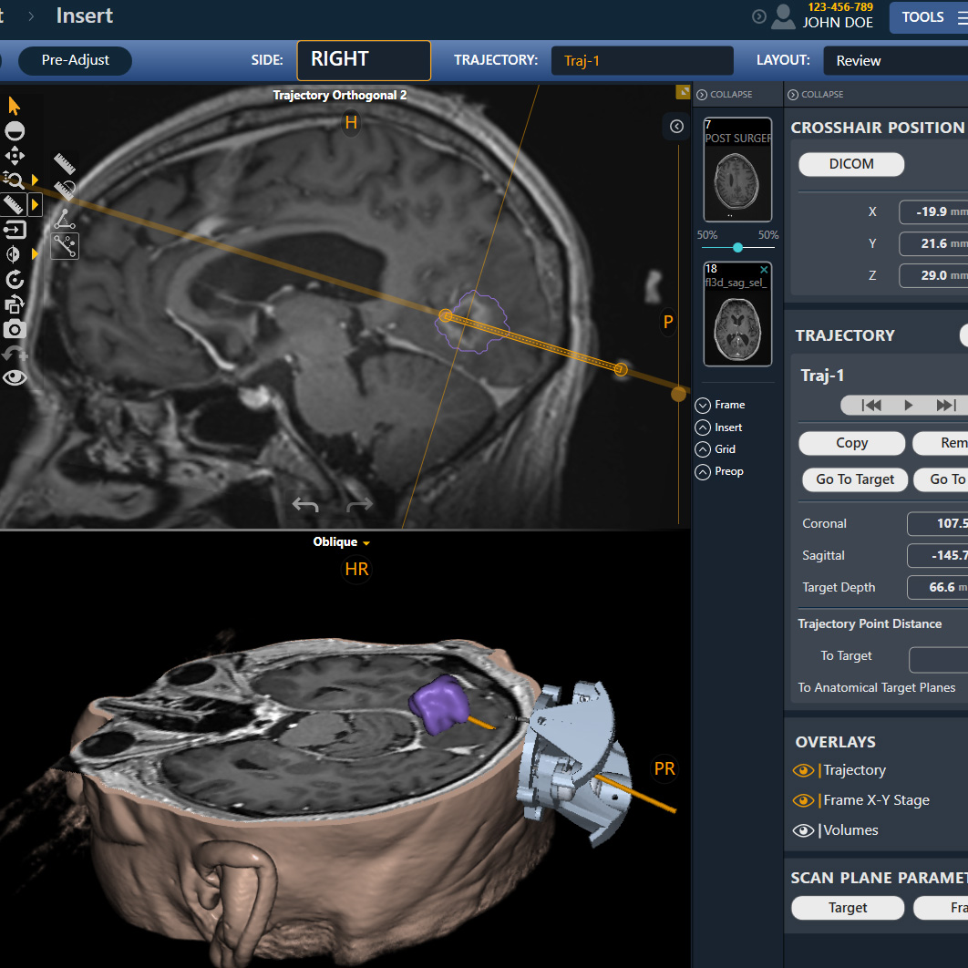 News & Events - ClearPoint Neuro