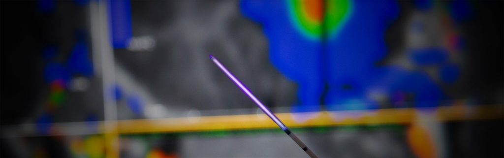 ClearPoint Prism Neuro Laser System - ClearPoint Neuro