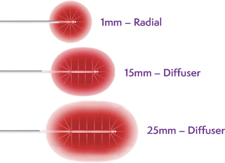 ClearPoint Prism Neuro Laser System - ClearPoint Neuro