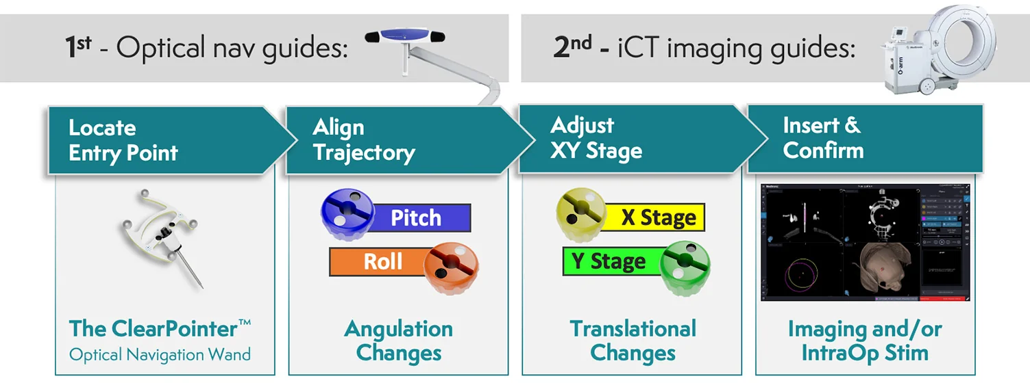 SmartFrame OR for Neurosurgeons with MRI-Guidance Experience ...