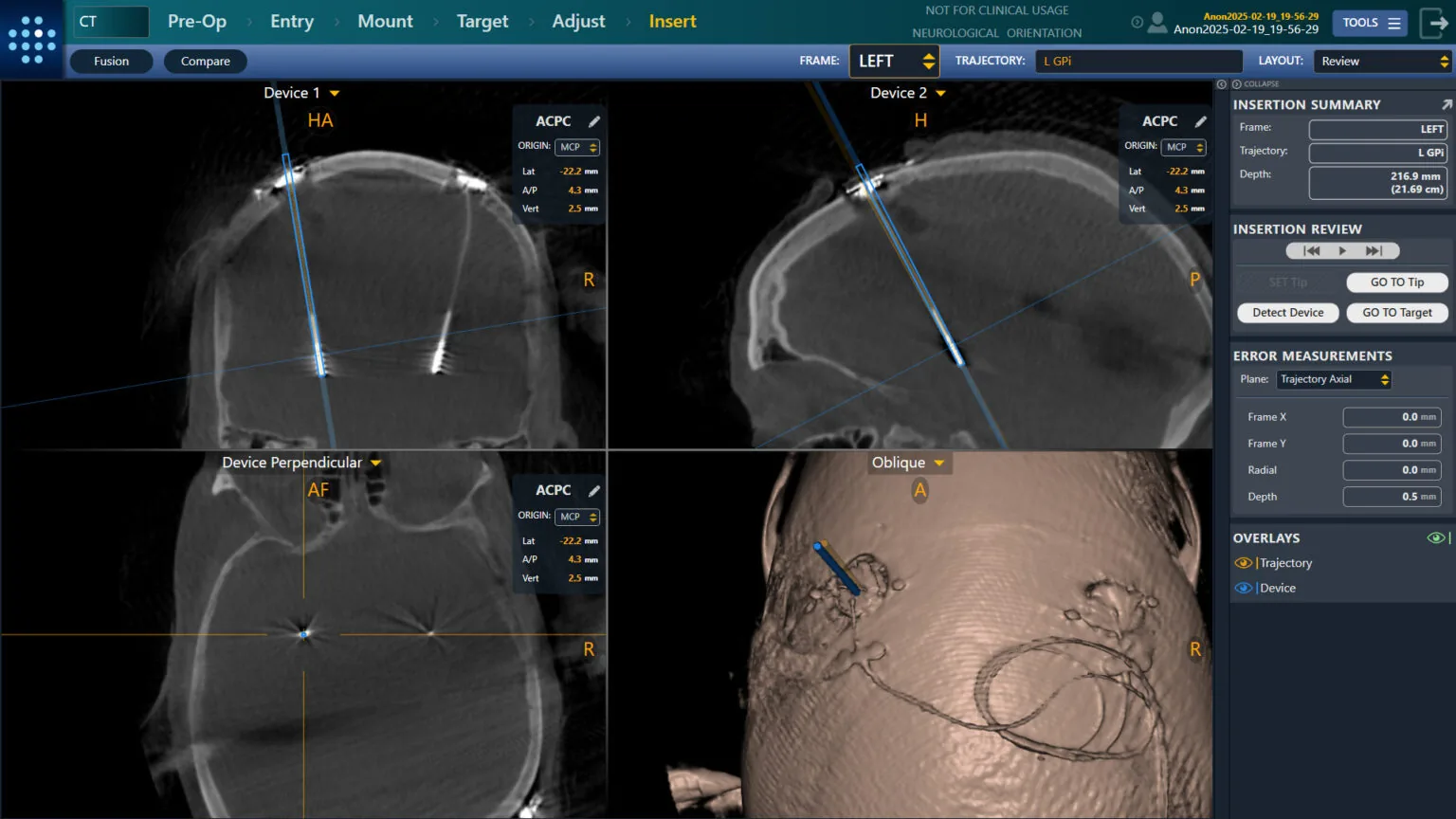 Neuro Navigation System Software - ClearPoint Neuro
