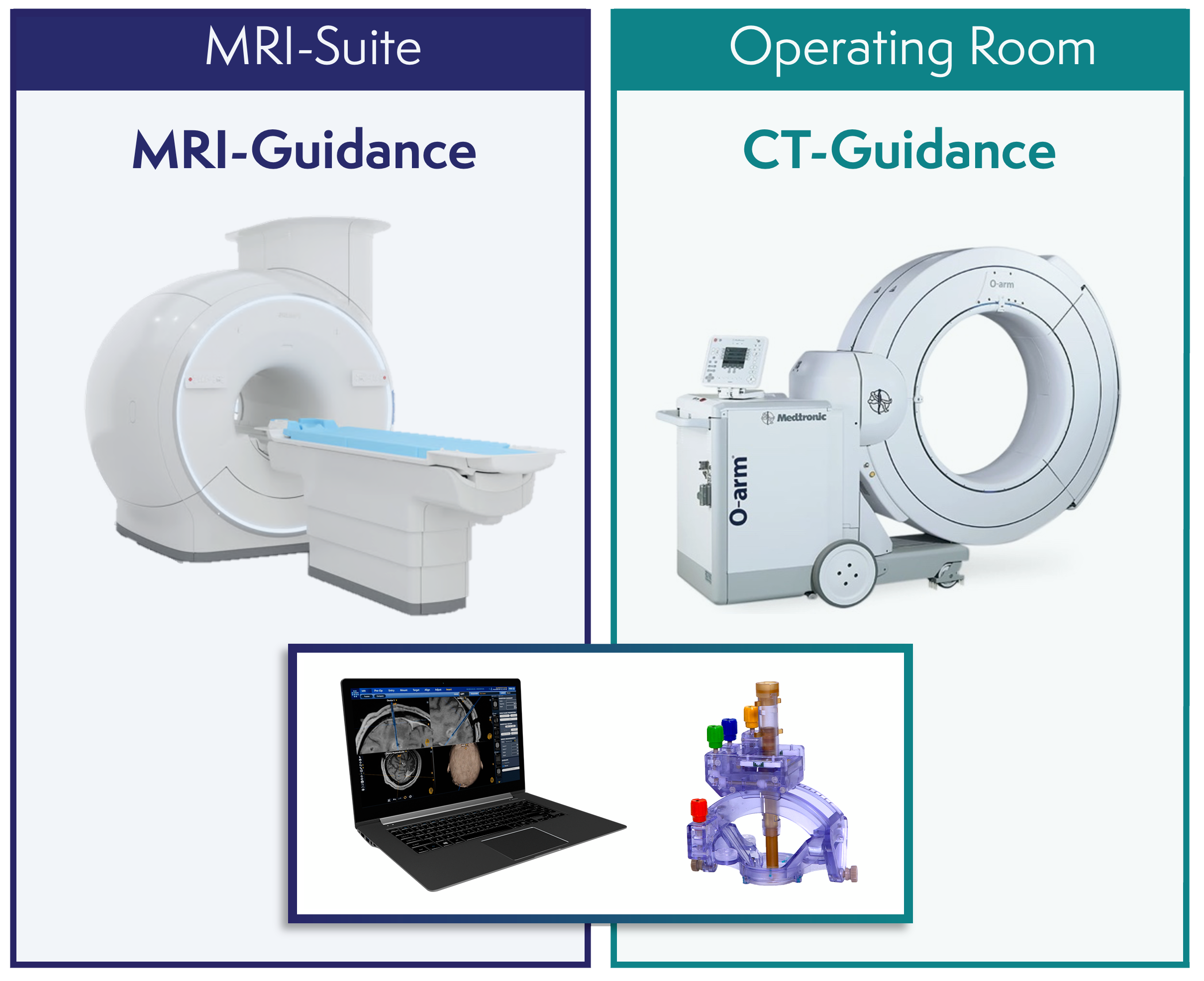 Neuro Navigation System Software - ClearPoint Neuro